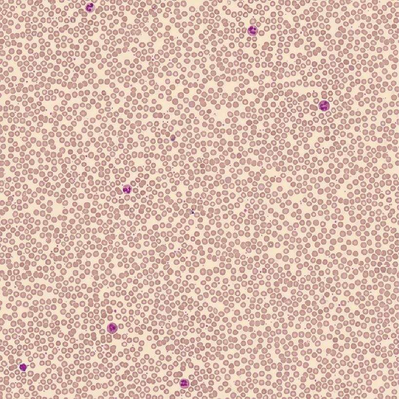 One staining, one story: May-Grünwald Giemsa | CellaVision